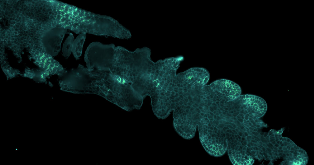 Spatial Transcriptomics In Plants Workshop Earlham Institute